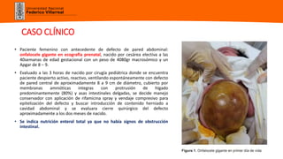 ONFALOCELE PRÁCTICA.pptx