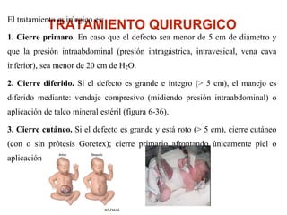 Onfalocele y gastrosquisis | PPTX
