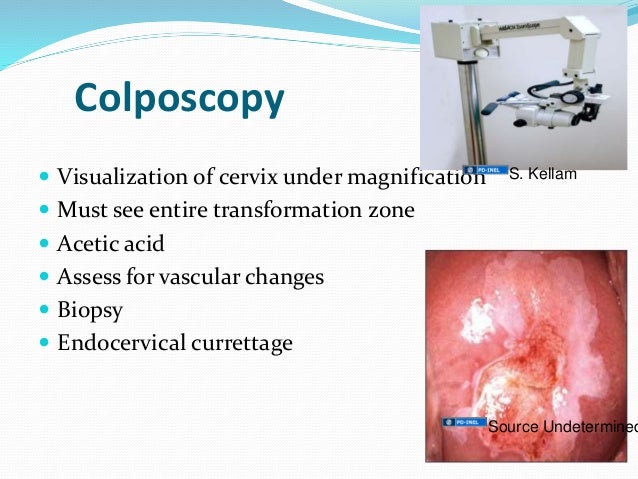 Diagnosis and treatment of the main gynaecological diseases