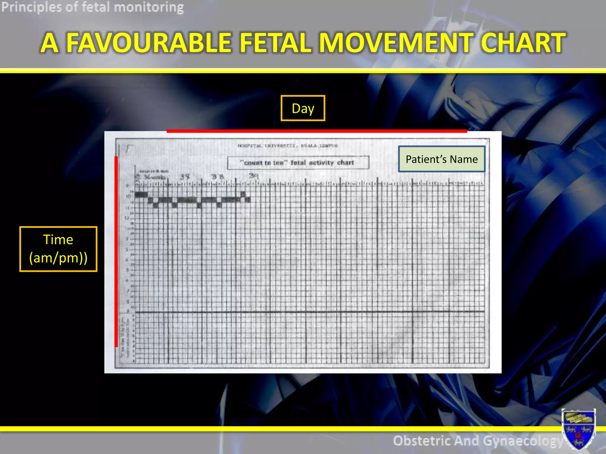 Foetal Monitoring | PPTX