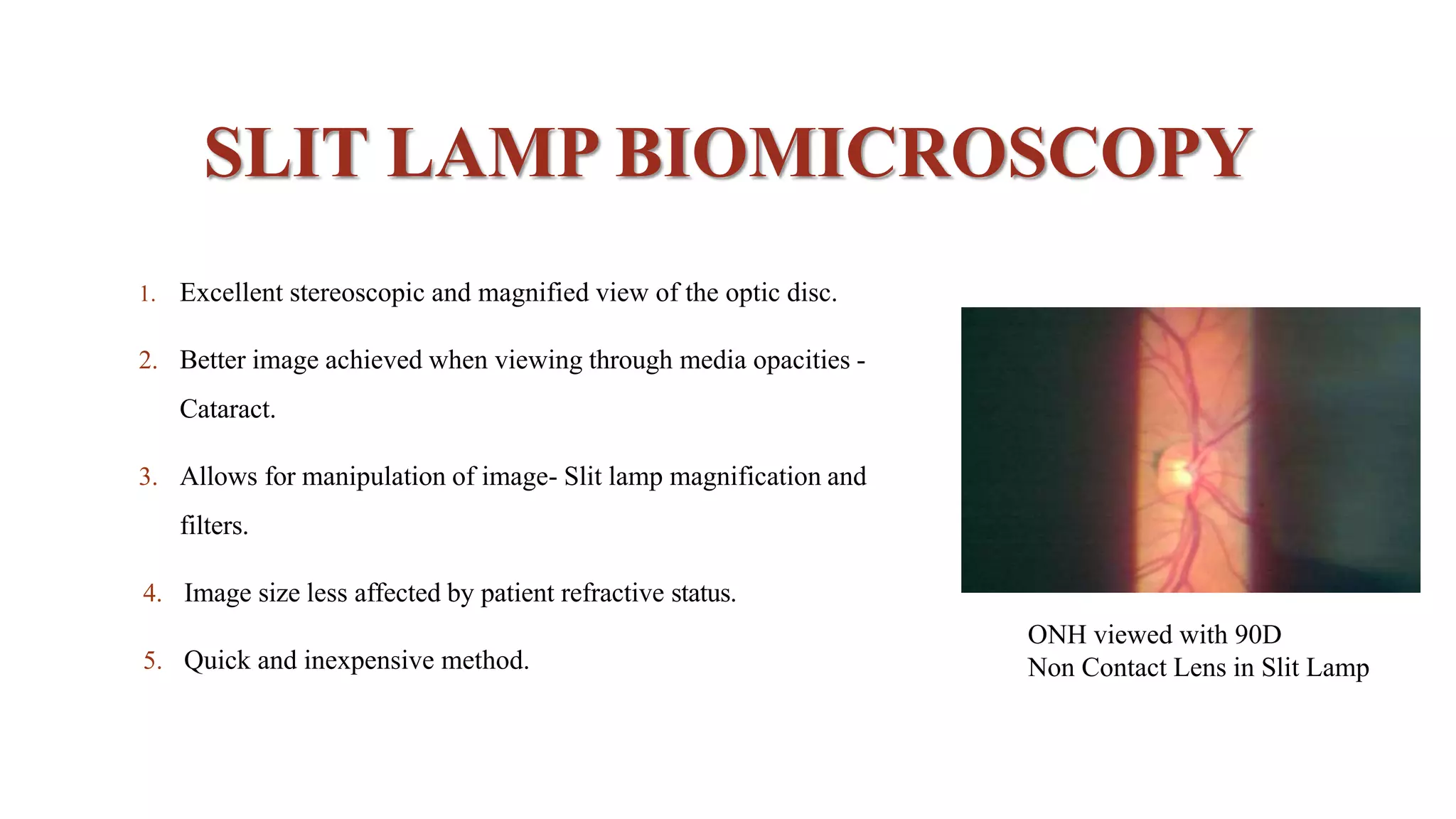 Optic Nerve Head Evaluation.pptx