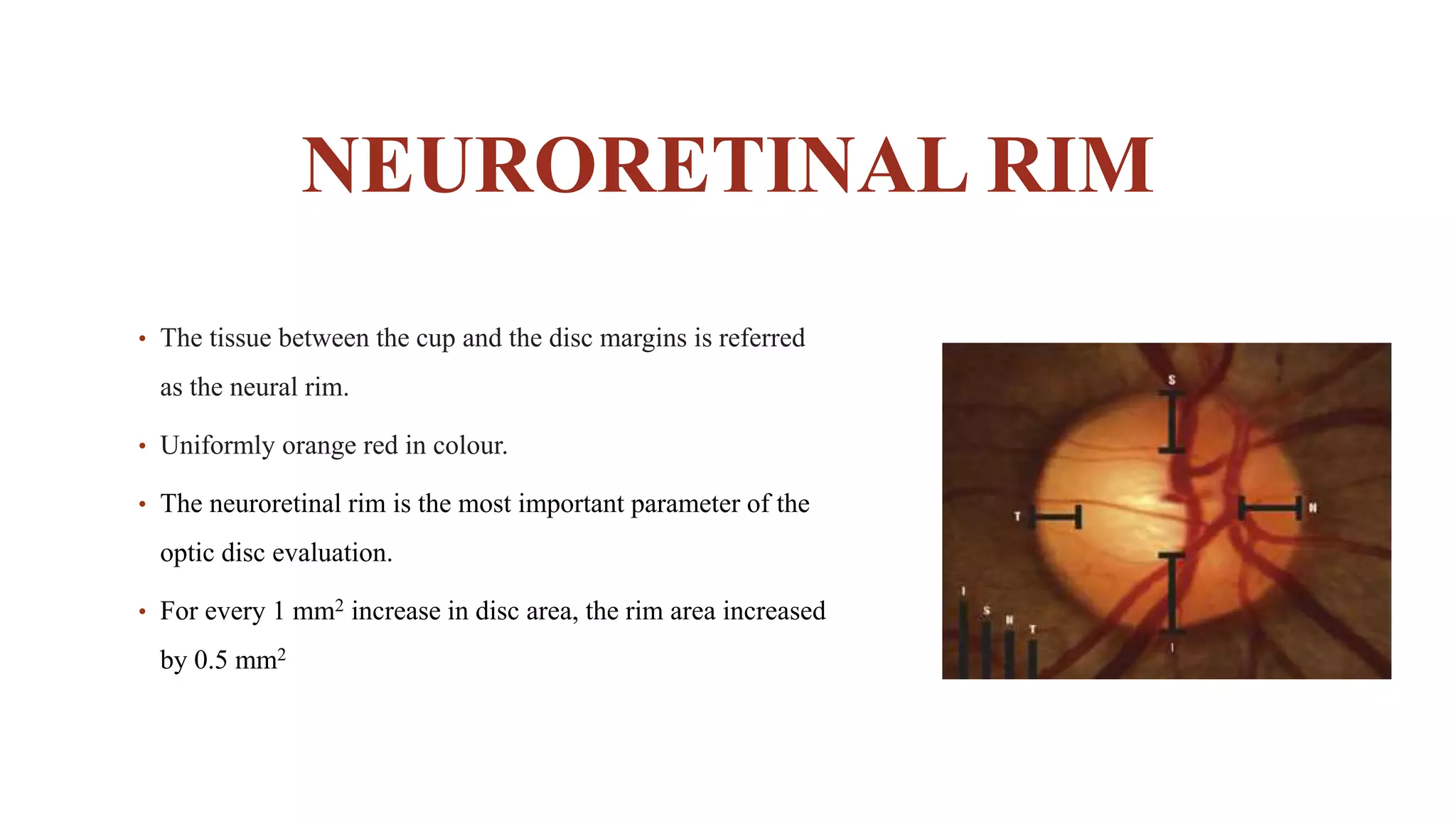 Optic Nerve Head Evaluation.pptx