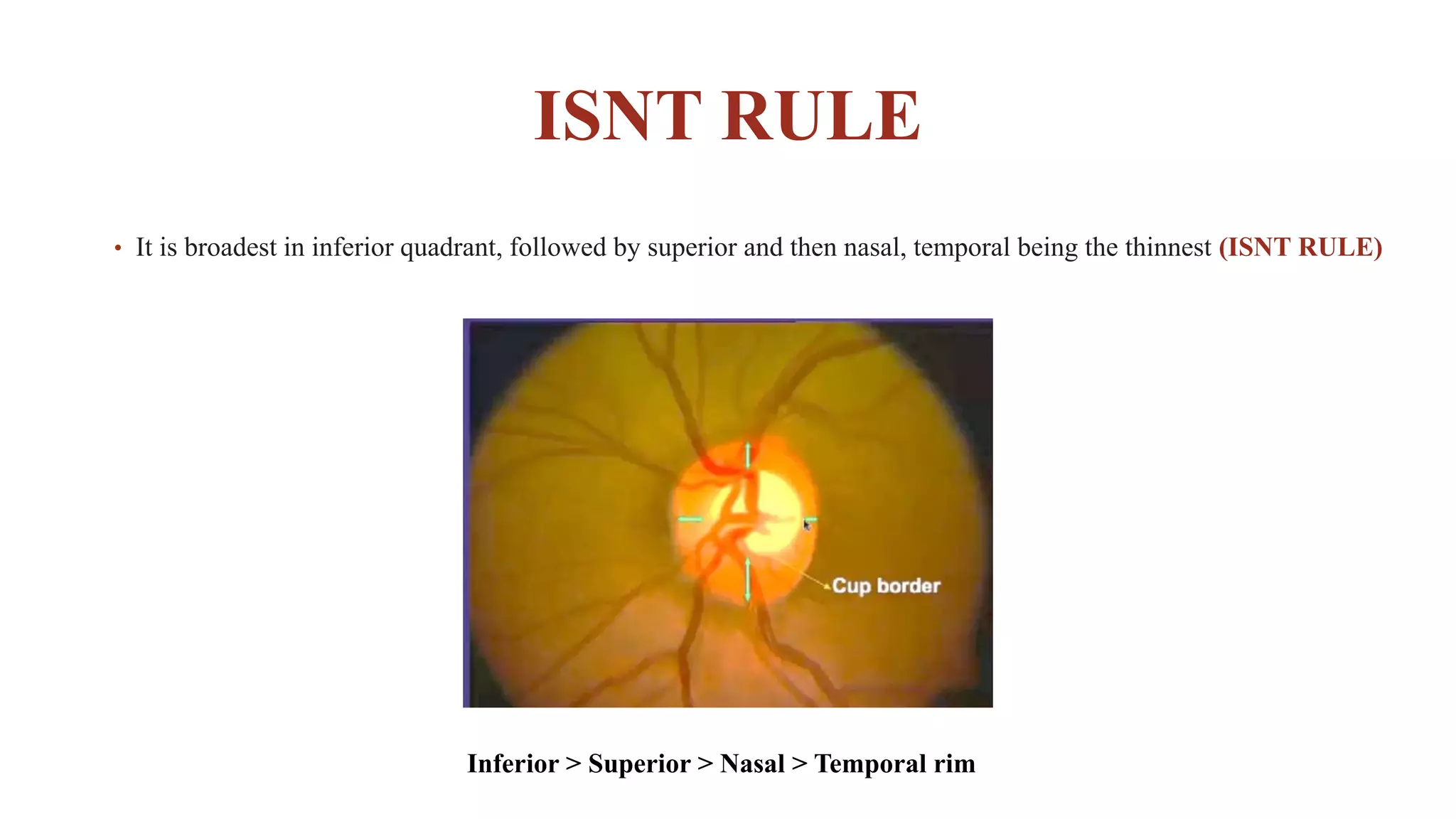 Optic Nerve Head Evaluation.pptx