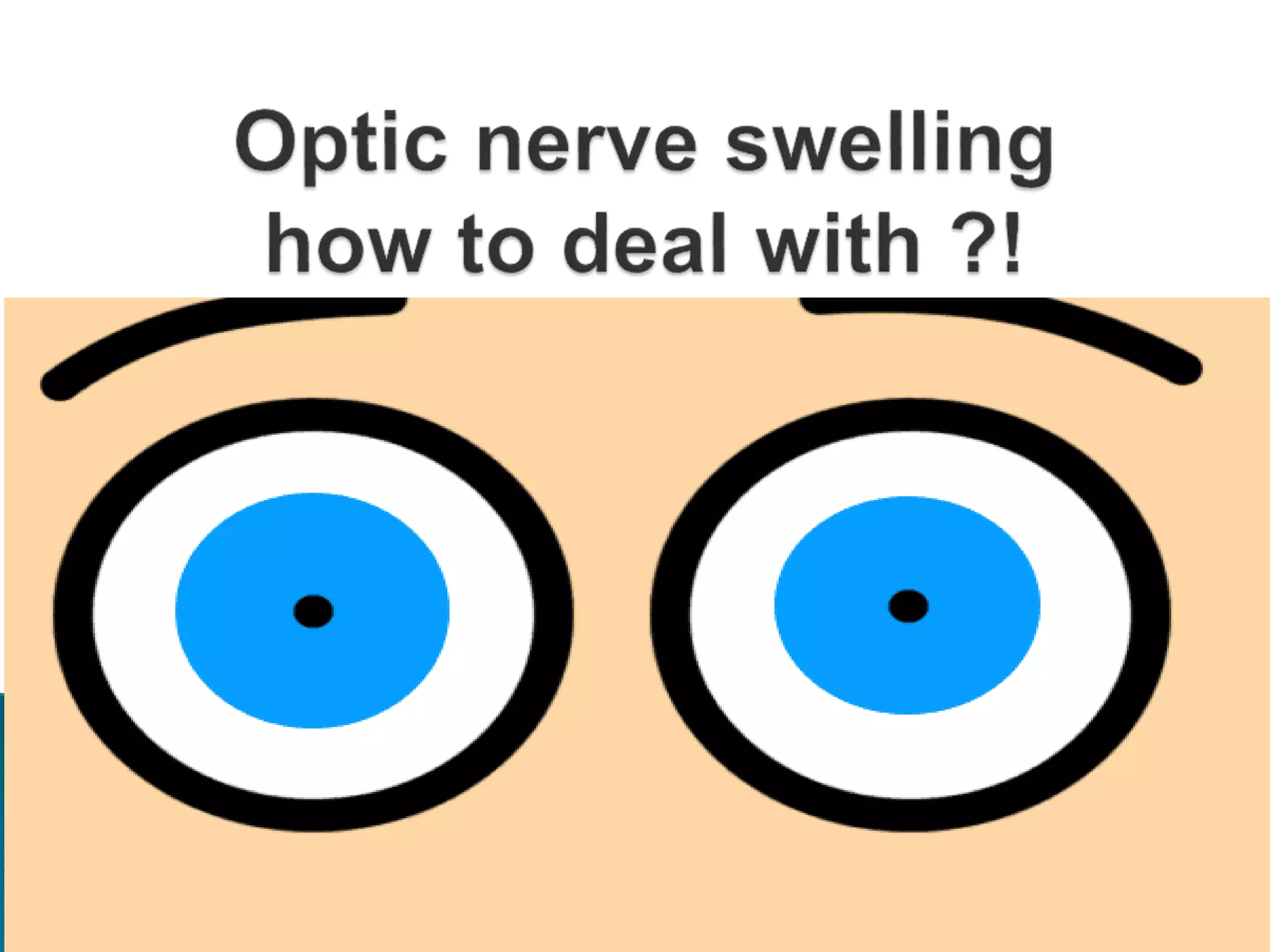 optic nerve head swelling | PPTX | Eye and Vision Conditions | Diseases ...