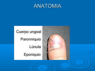 Onicocriptosis clasificacion t tratamiento | PPT