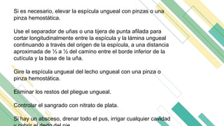 onicocriptosis o uña encarnada patología de uñas | PPTX
