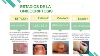 onicocriptosis o uña encarnada patología de uñas | PPTX