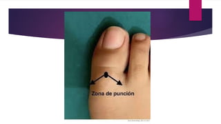 ONICOCRIPTOSIS Y MATRICEPTOMIAaaaaa.pptx