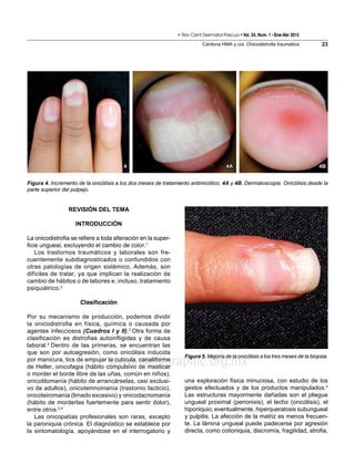 ONICO DISTROFIA TRAUMATICA Y ALTERACION DE LA UÑA | PDF