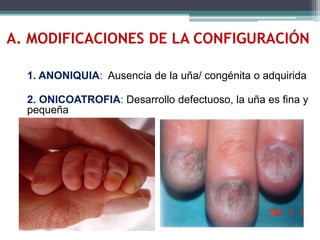 ONICOPATIAS.pptx