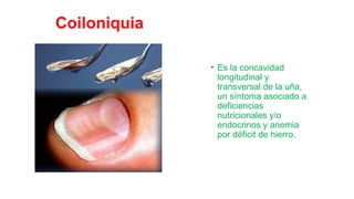 Tipos de Onicopatologias y sus definicionespptx | PPTX