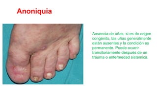 Tipos de Onicopatologias y sus definicionespptx | PPTX