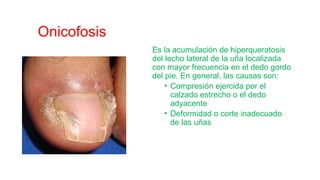 Tipos de Onicopatologias y sus definicionespptx | PPTX