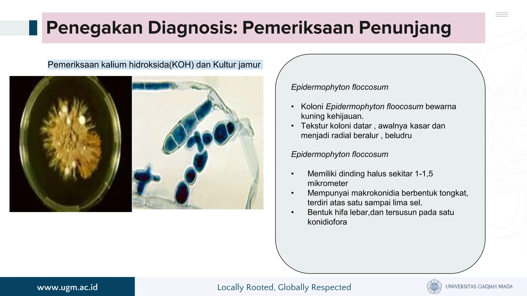 Onikomikosis otomikosis otomikosis otominosis | PPTX