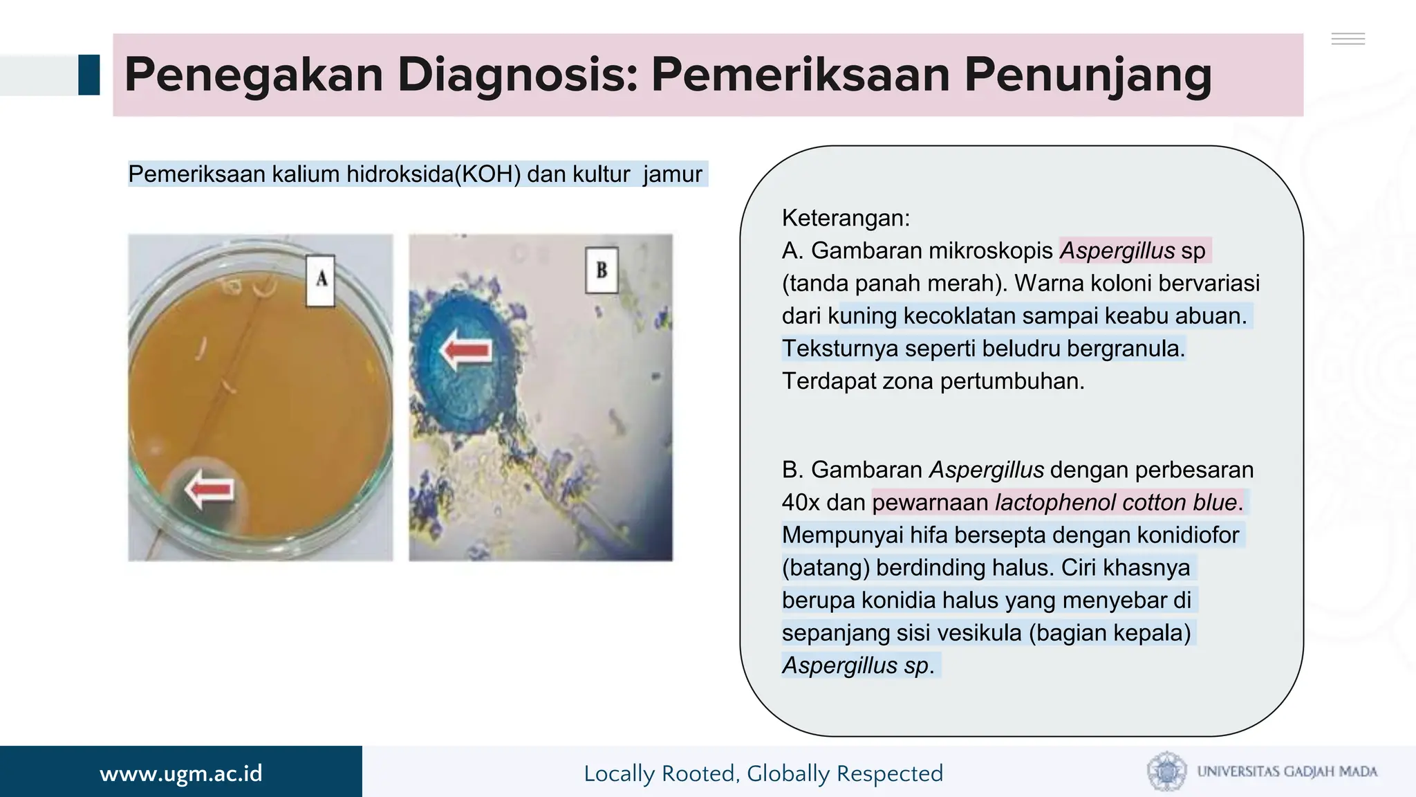 Onikomikosis otomikosis otomikosis otominosis | PPTX