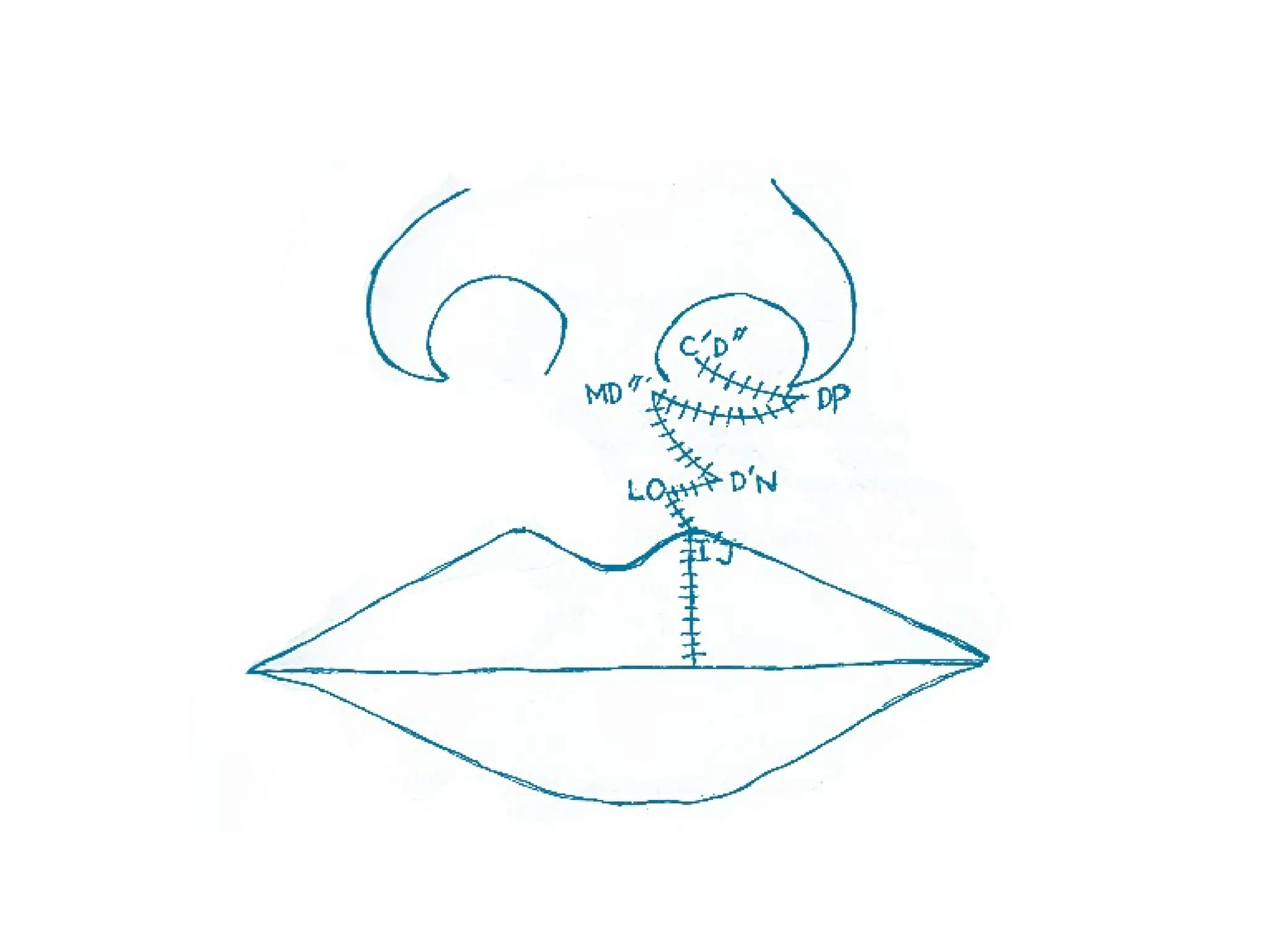 Onizuka Refrat Mayor Pebrian [Autosaved].pptx