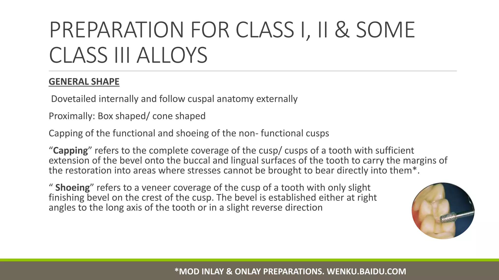 Onlay preparations | PPTX