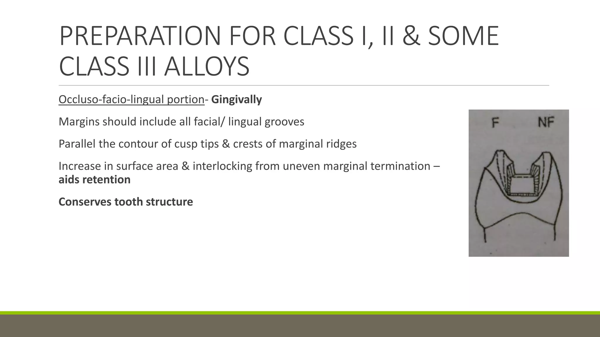 Onlay preparations | PPTX