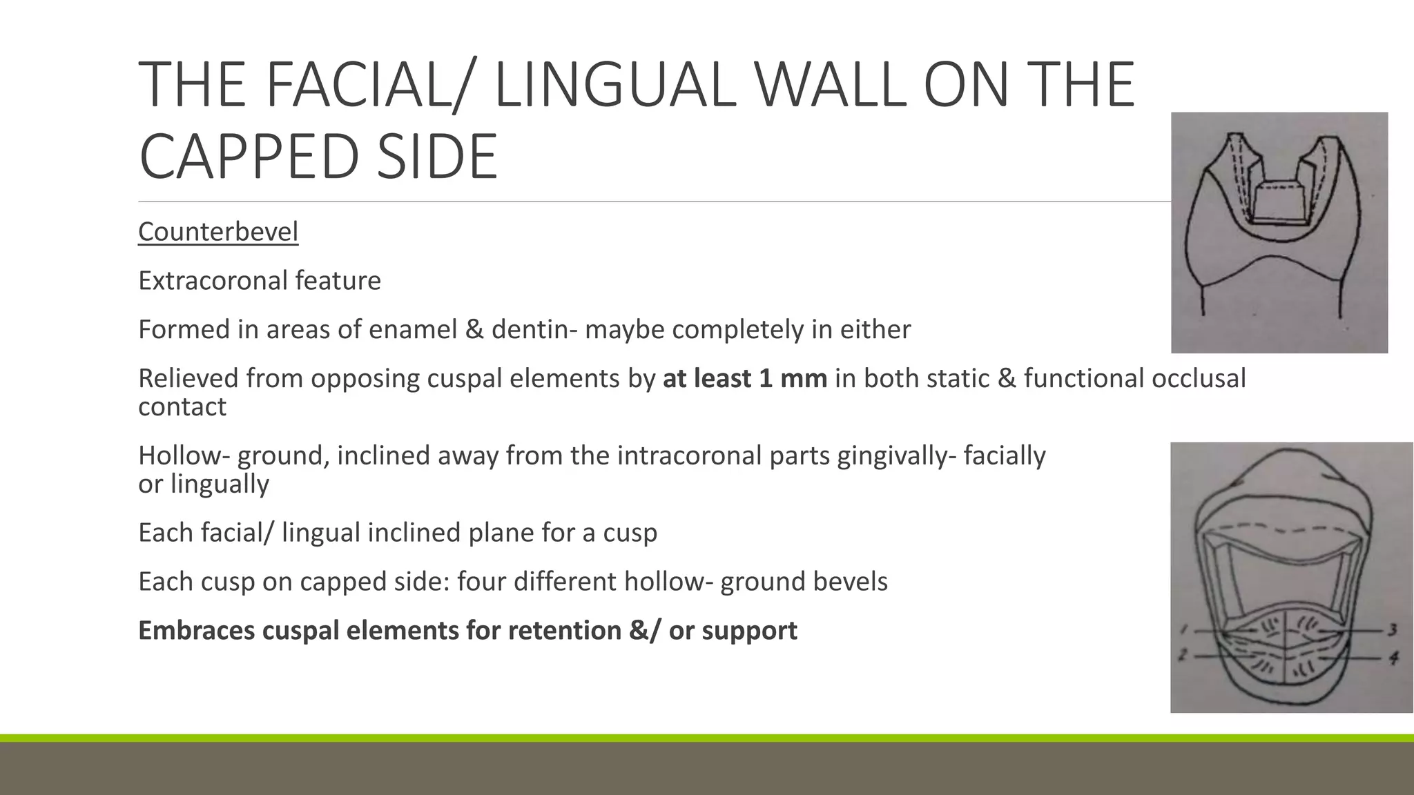 Onlay preparations | PPTX