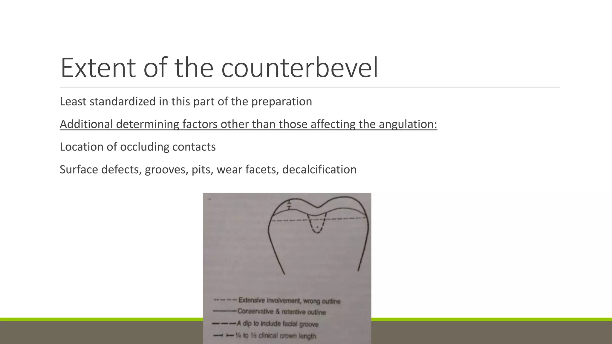 Onlay preparations | PPTX