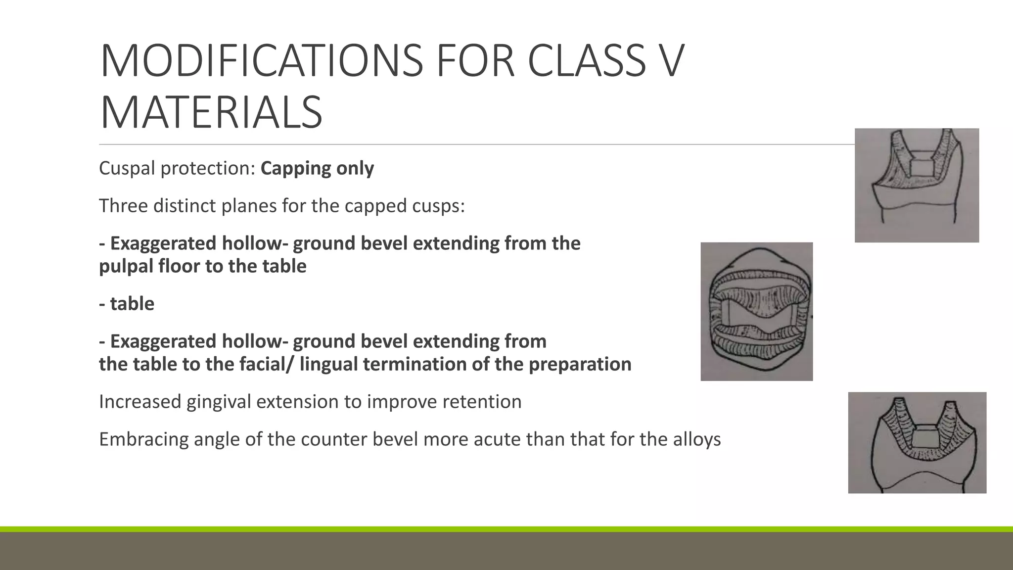 Onlay preparations | PPTX