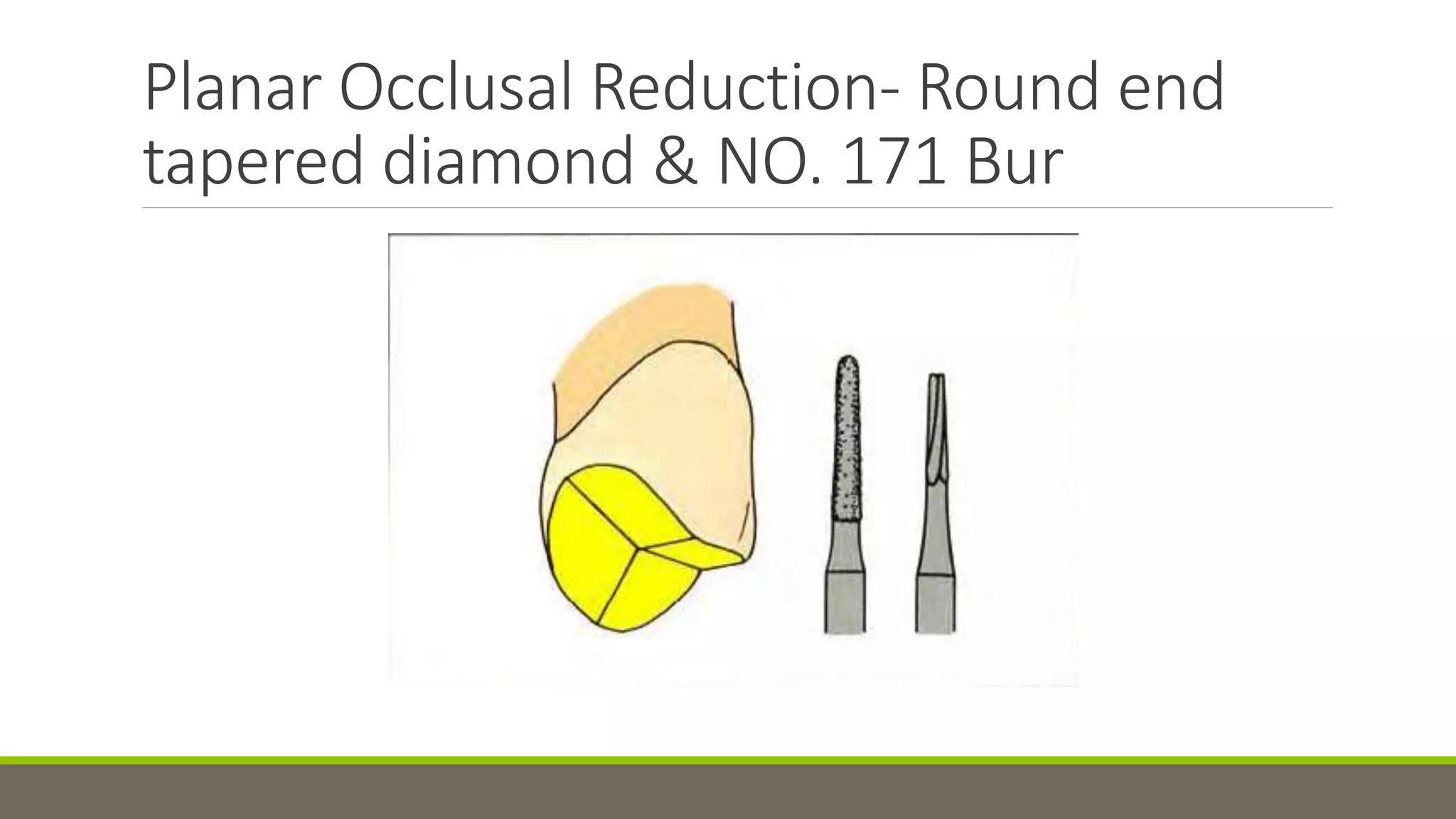 Onlay preparations | PPTX