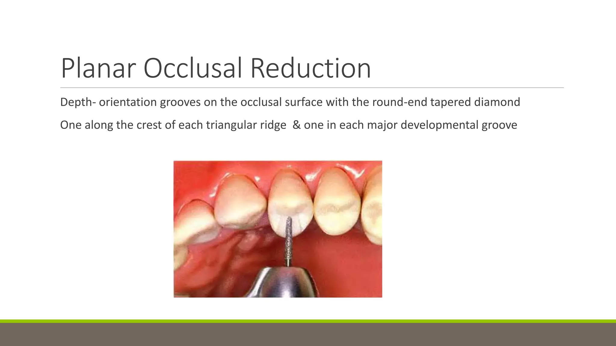 Onlay preparations | PPTX