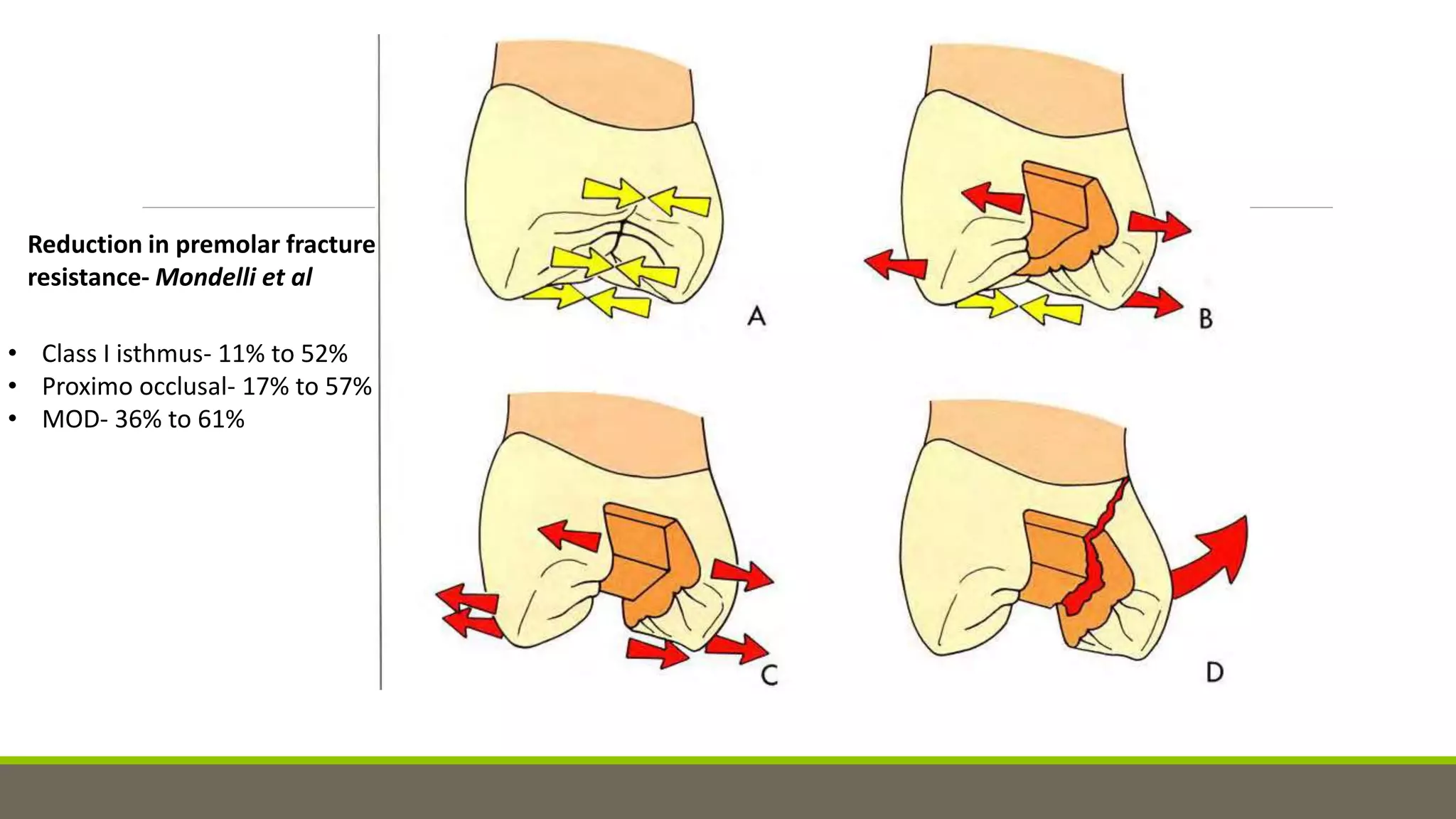 Onlay preparations | PPTX