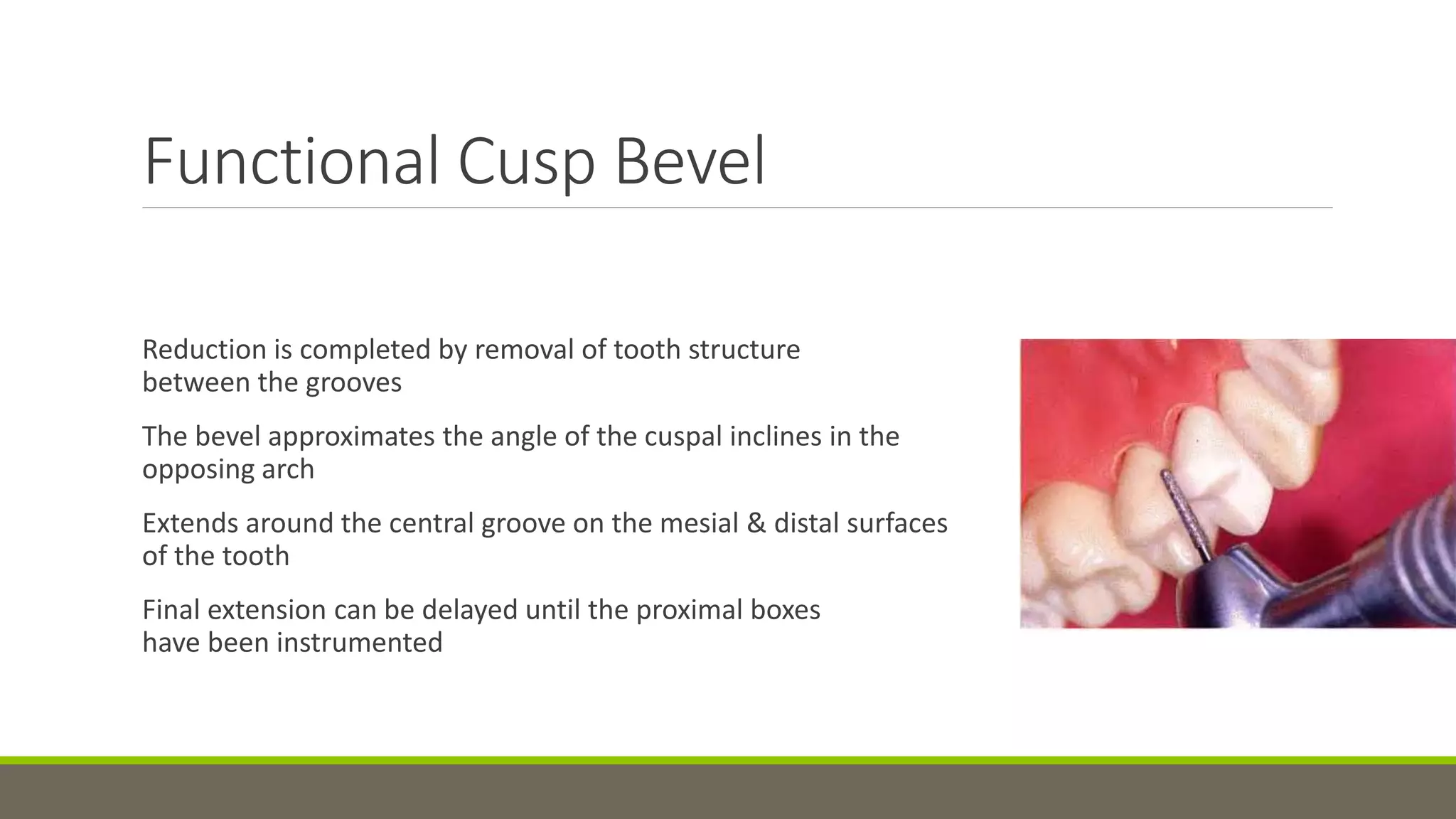 Onlay preparations | PPTX