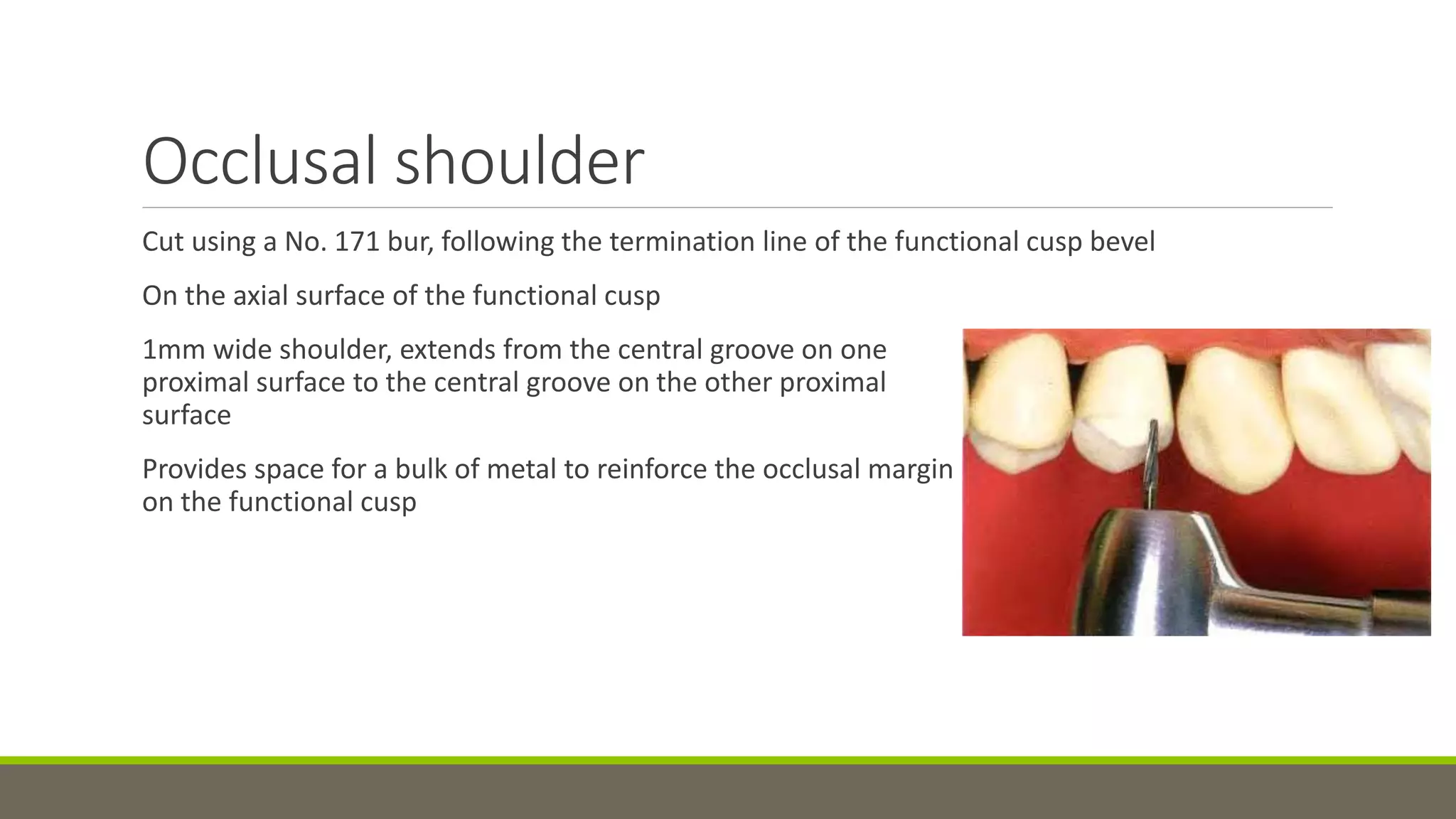 Onlay preparations | PPTX