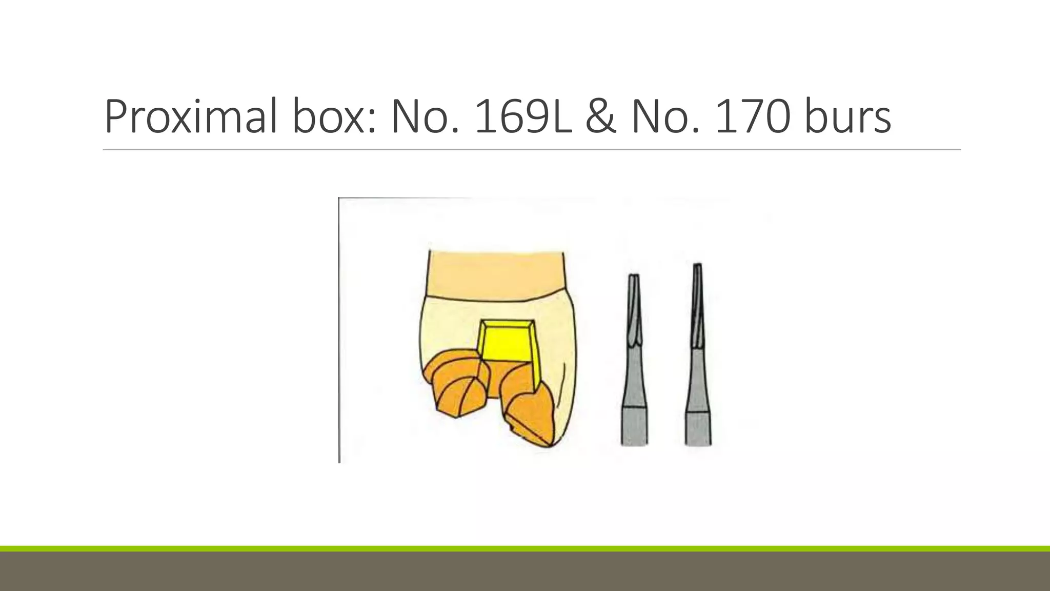 Onlay preparations | PPTX