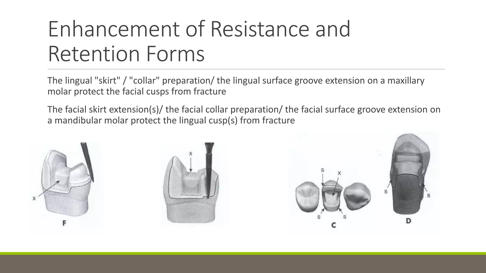 Onlay preparations | PPTX