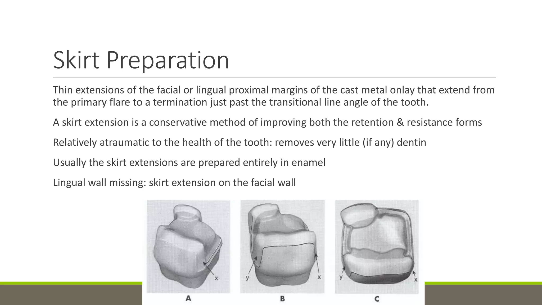 Onlay preparations | PPTX