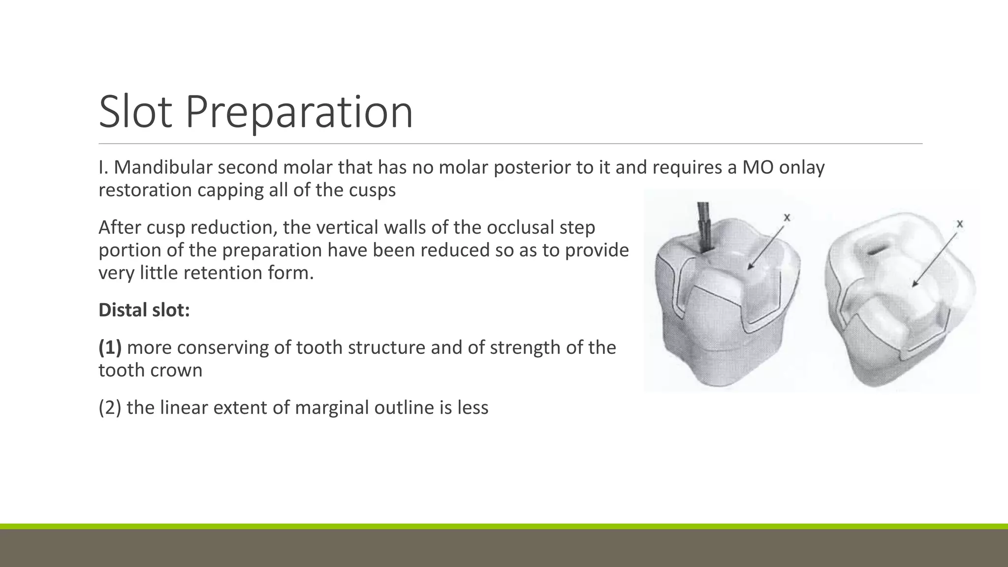 Onlay preparations | PPTX