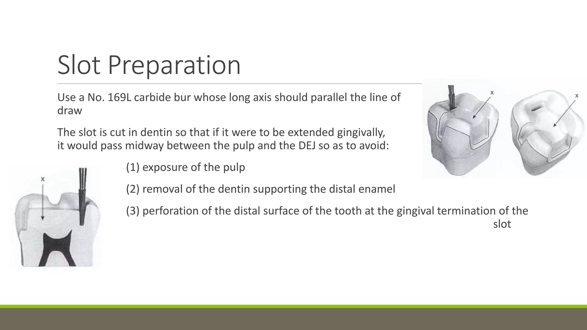 Onlay preparations | PPTX