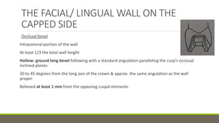 Onlay preparations | PPTX