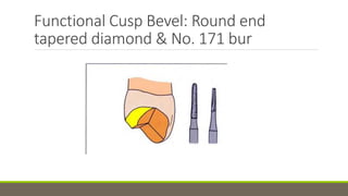 Onlay preparations | PPTX