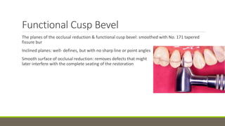 Onlay preparations | PPTX