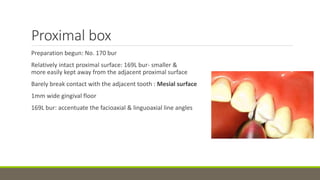 Onlay preparations | PPTX