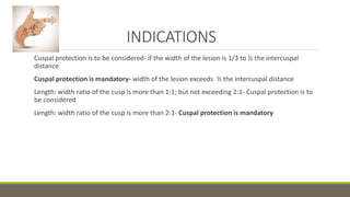 Onlay preparations | PPTX