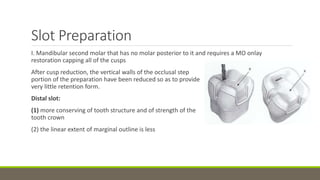 Onlay preparations | PPTX