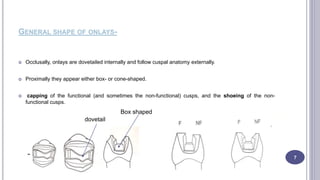 onlays edit.ppt