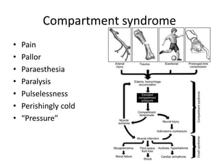 Orthopaedics 101 | PPTX