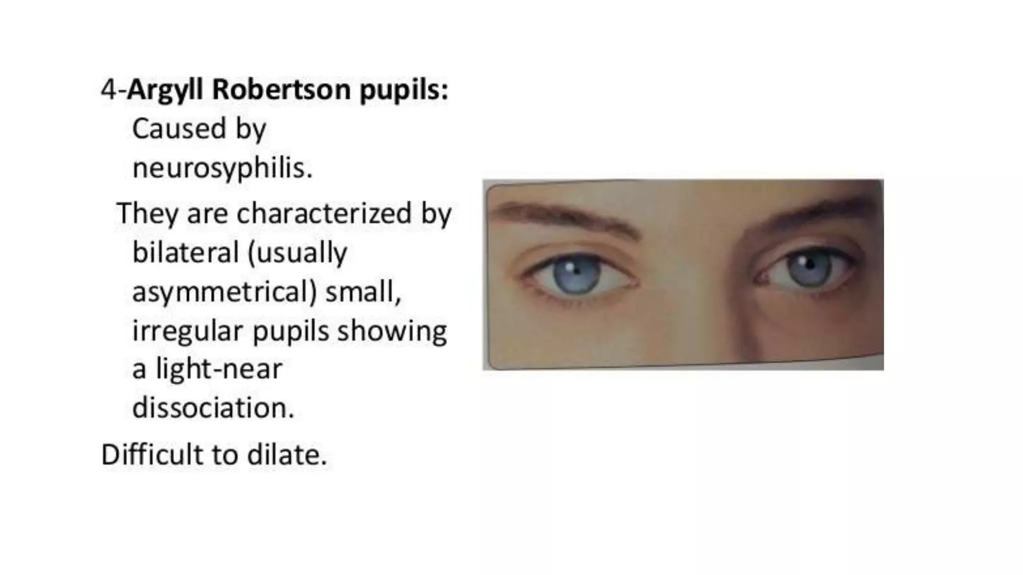 Optic Nerve and pupil tutorial | PPTX