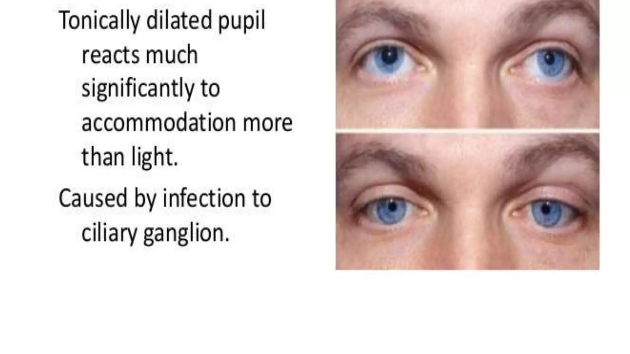 Optic Nerve and pupil tutorial | PPT
