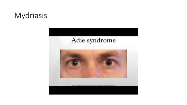 Optic Nerve and pupil tutorial | PPT