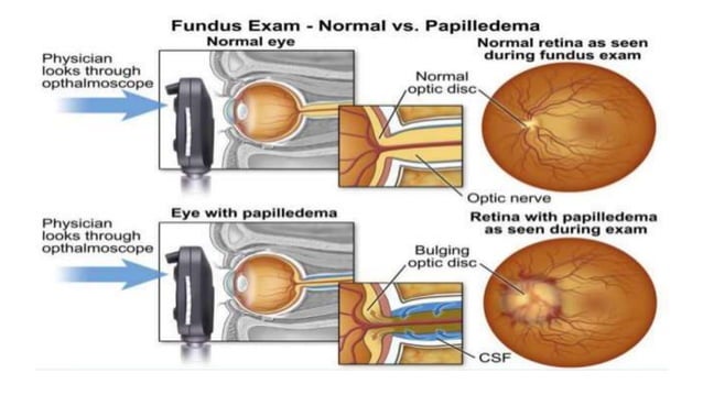 Optic Nerve and pupil tutorial | PPT