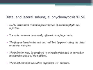 onychomycosis-tim-copy-190413065334 (1).pptx