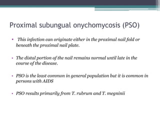 onychomycosis-tim-copy-190413065334 (1).pptx