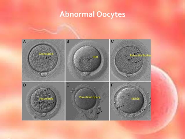 Oocyte | PPT